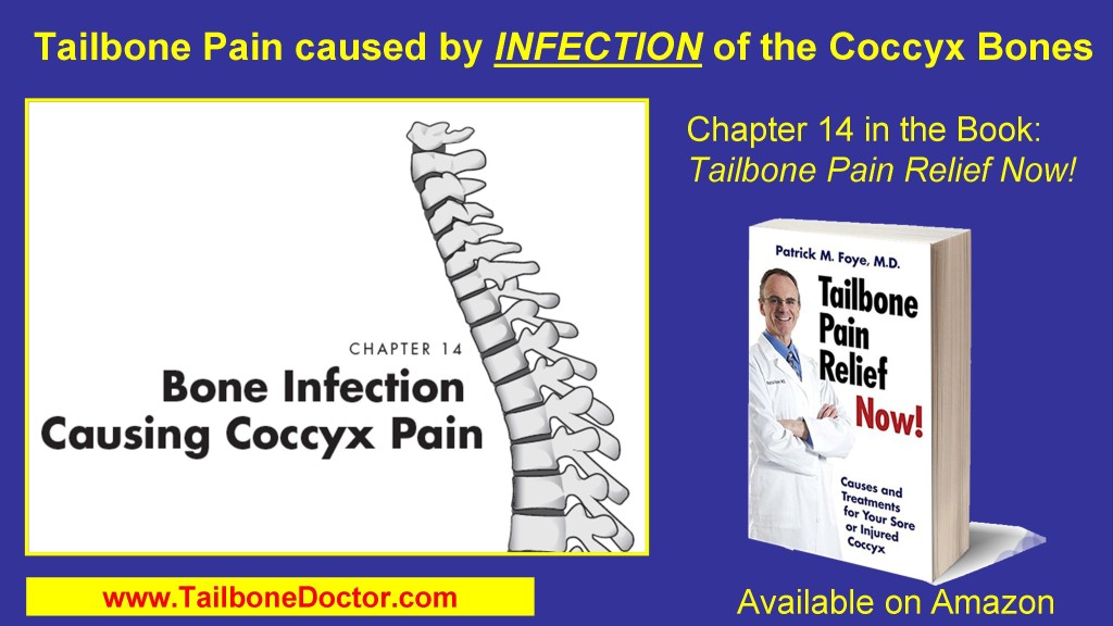 Tailbone Pott’s Disease: Coccyx Tuberculosis | Tailbone Doctor