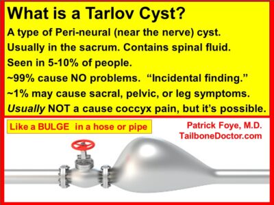 How to Tell Tarlov Cyst Pain from Tailbone Pain (Coccyx Pain ...