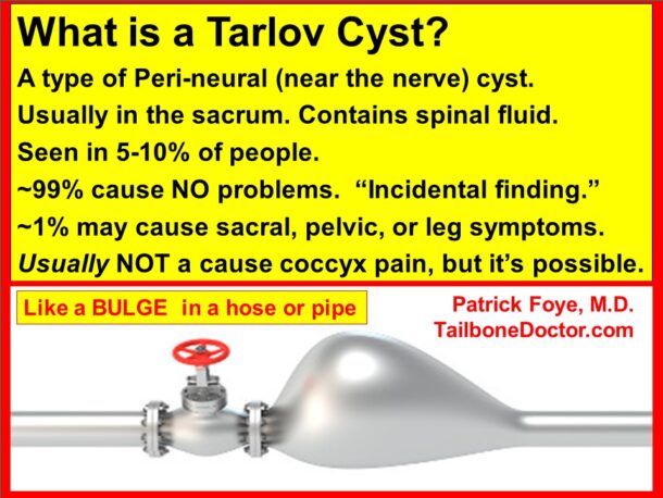 How to Tell Tarlov Cyst Pain from Tailbone Pain (Coccyx Pain ...